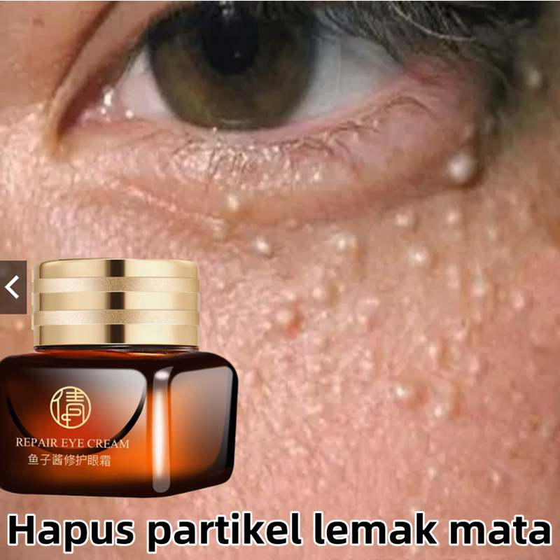 Jual Eye Cream Mata Panda Krim Mata Fat-Free Granules Anti Penuaan Krim ...