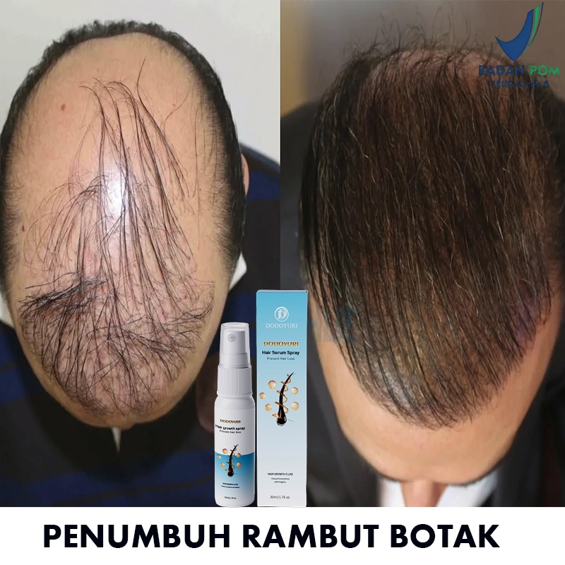 Jual (BPOM)Obat penumbuh rambut penumbuh rambut cepat serum penumbuh ...