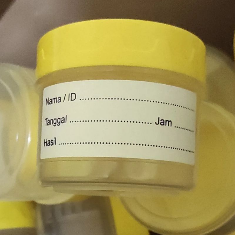 Jual Sample Container Nousmed Non Sterile 60ml / Pot Urine / Sputum Pot ...