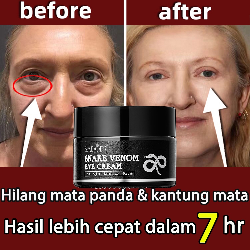 Jual Cream mata bisa ular untuk Mengurangi Dark Circle Anti-Wrinkle ...