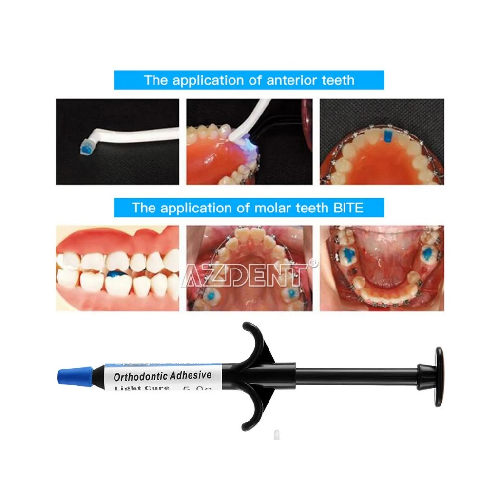 Jual Orthobite Ortho Bite Resin Peninggi Gigitan Semen Molar Band ...