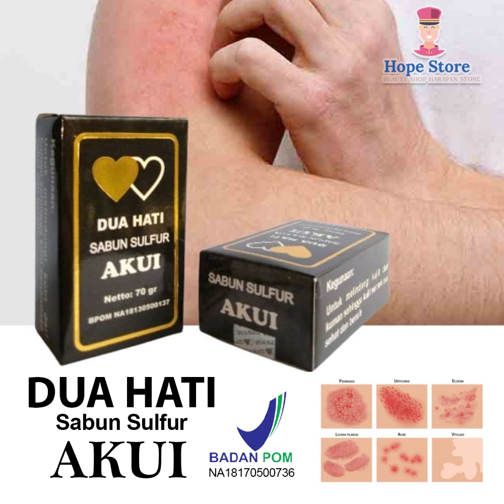 Jual HOPE STORE - BISA COD -Sabun Sulfur Belerang /Sabun Belerang ...