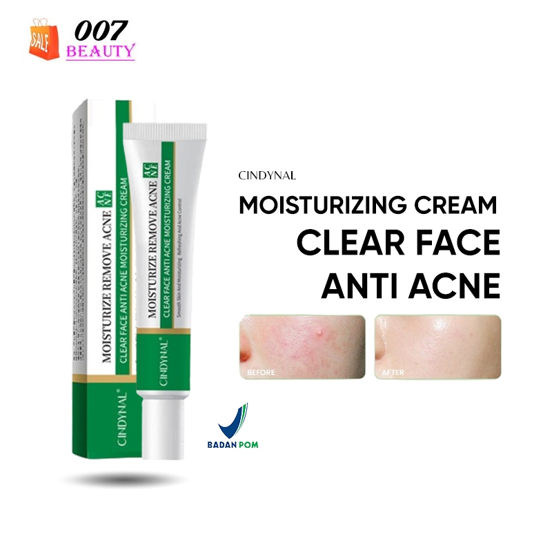 Jual BPOM CINDYNAL Moisturizing Cream Anti Acne Remove Acne Fast - Obat Jerawat Paling Ampuh ...
