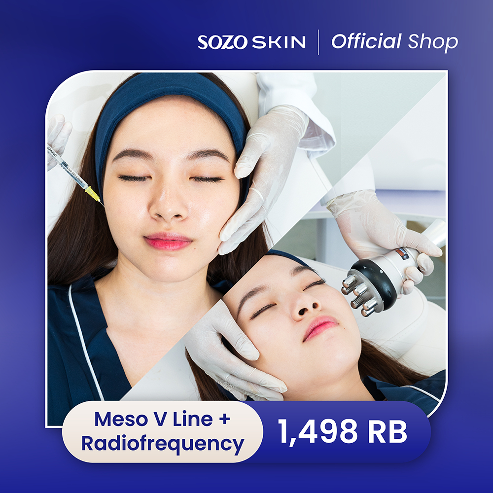 Jual SOZO SKIN Meso V Line + Radiofrequency | Shopee Indonesia