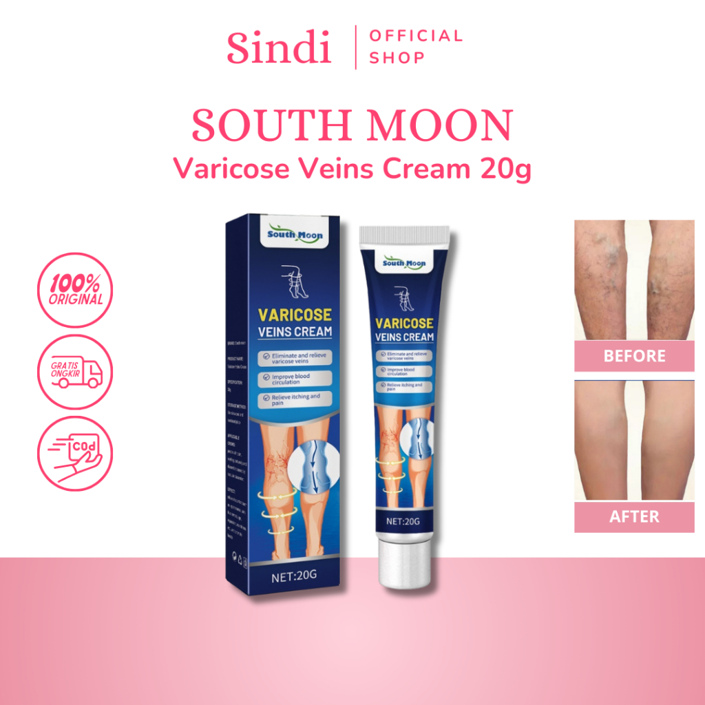 Jual Varicose Veins obat varises di kaki dan betis paling ampuh salep ...