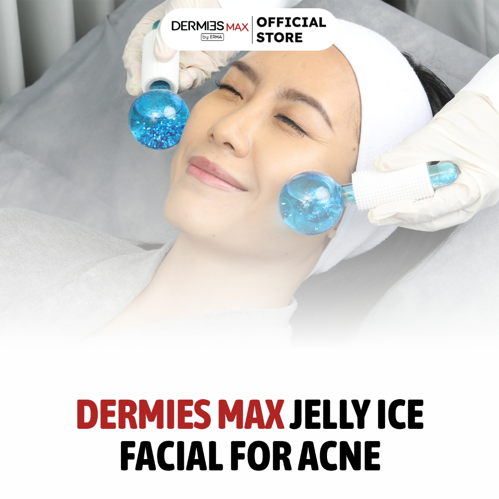 Jual Dermies Max Jelly Ice Facial for Acne | Shopee Indonesia