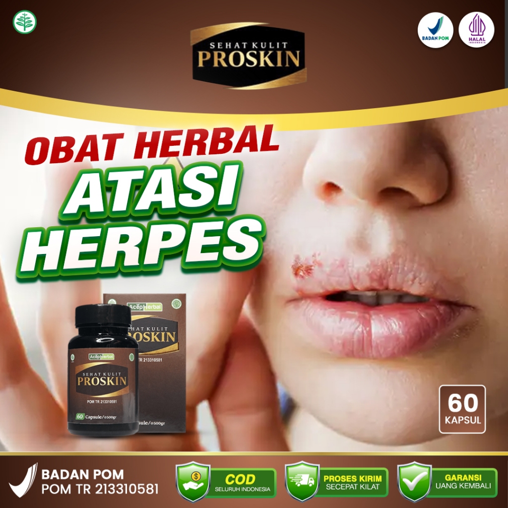 Jual Proskin Vitamin Herbal 100% Original - Obat Herpes Kudis Psoriasis ...