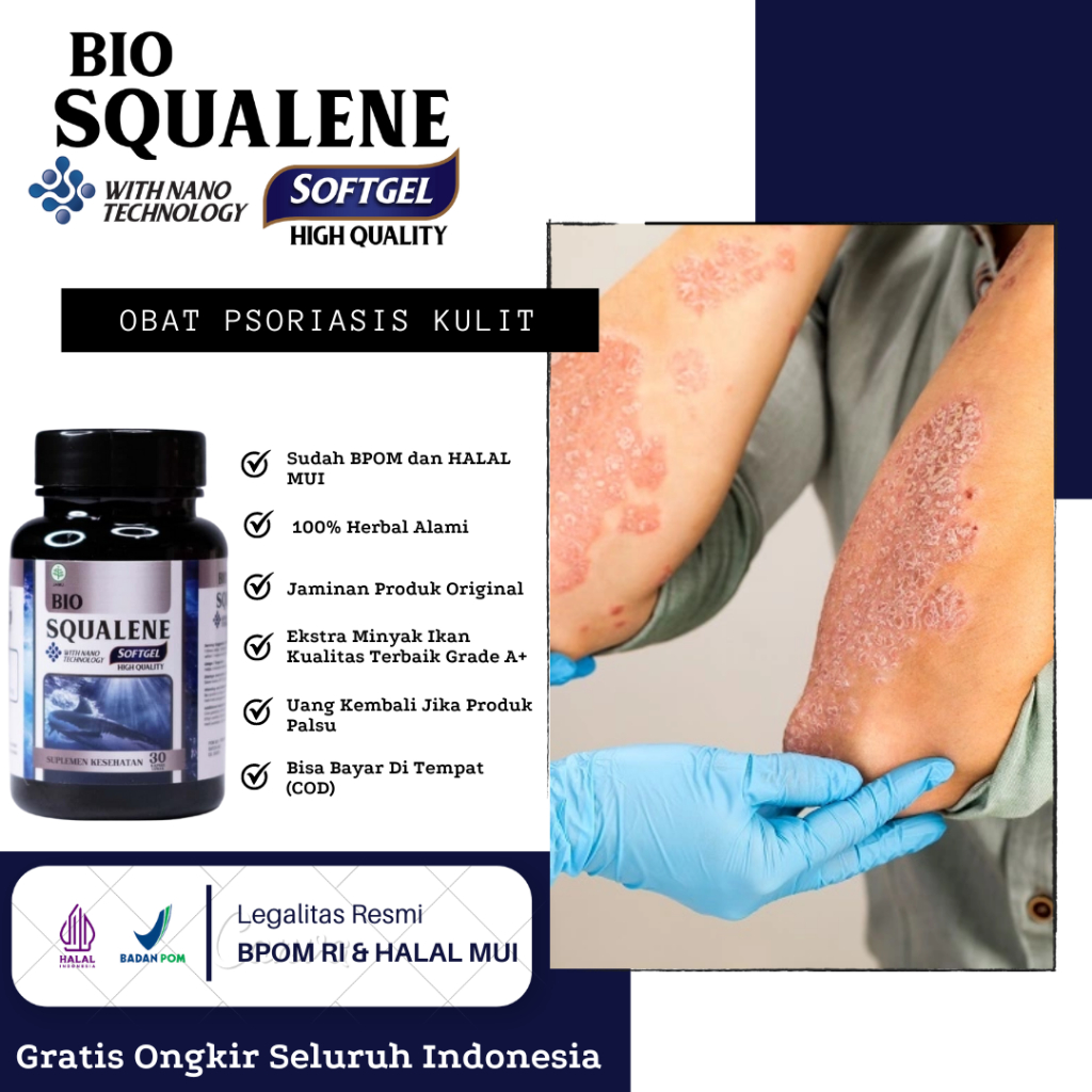 Jual Obat Psoriasis Kulit, Infeksi Kulit, Kurap Pada Kulit Kepala ...