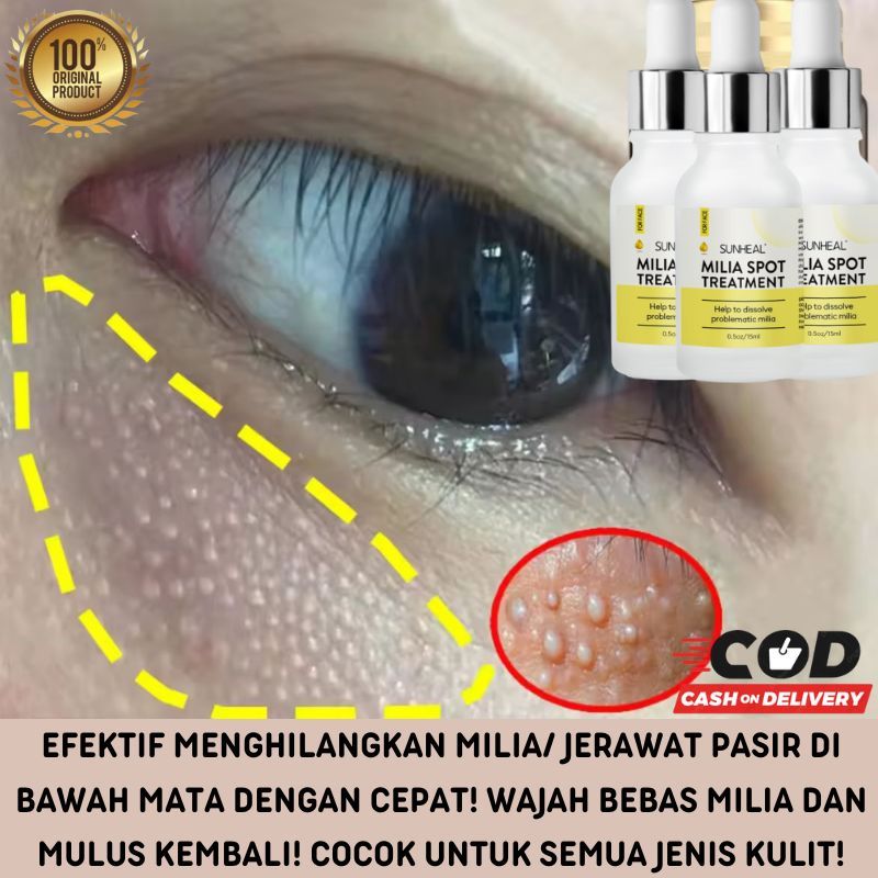 Jual Obat Penghilang Milia Penghilang Bintik Bintik Putih Di Bawah Mata Obat Milia Obat