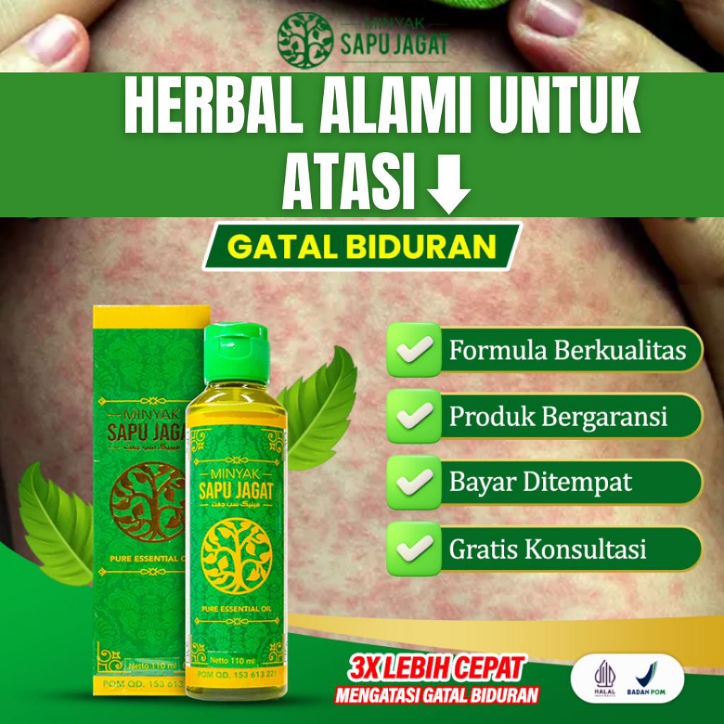 Jual Obat Oles Gatal Biduran Gatal Gatal Biduran Penyakit Kulit Panu ...