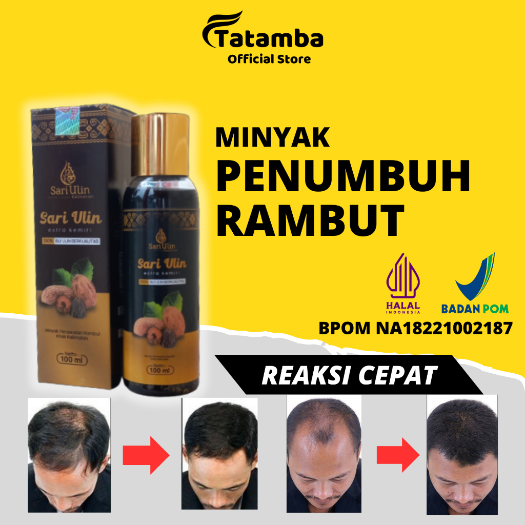 Jual Minyak Penumbuh Rambut Rontok Parah Cepat Sari Ulin Extra Kemiri ...