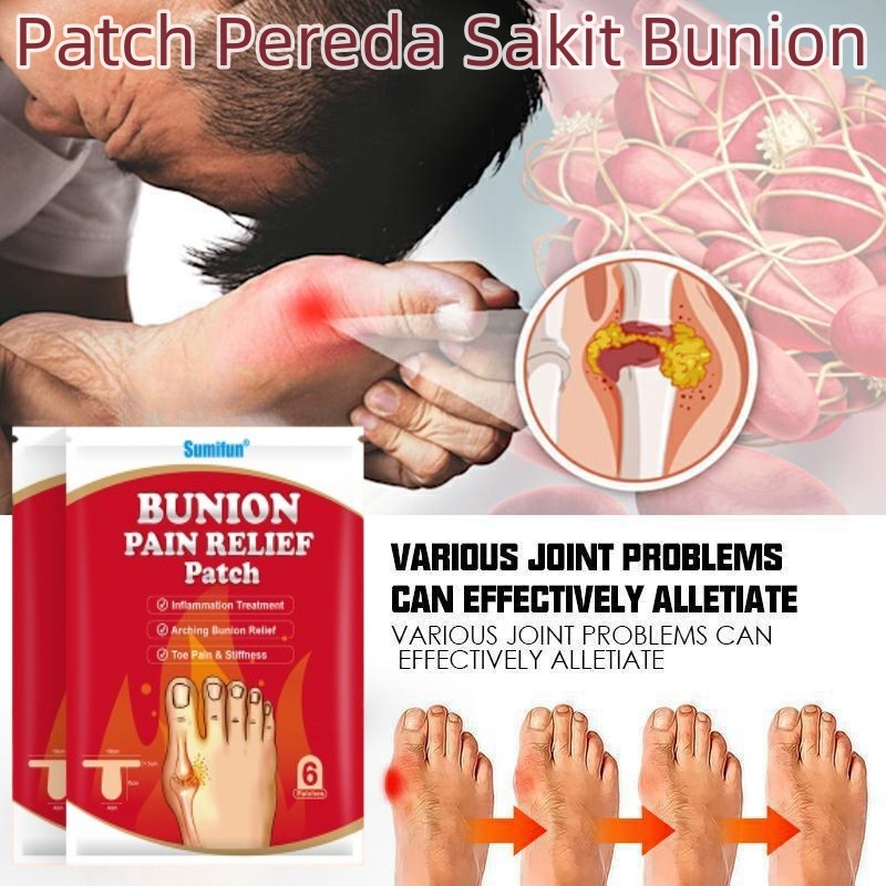 Jual Koyo Asam Urat patch bunion pain relief cream salep nyeri otot dan ...
