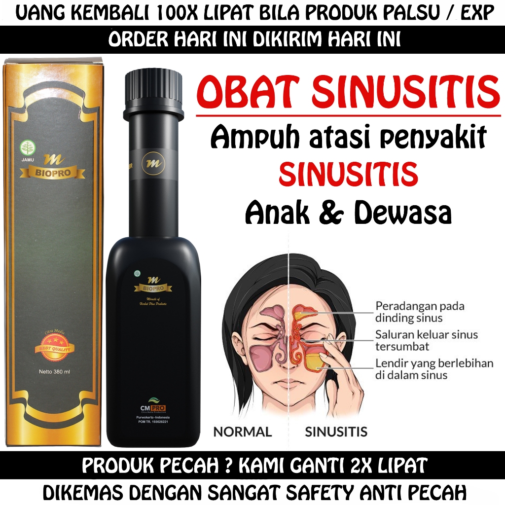 Jual Obat Sinusitis Anak & Dewasa, Polip Hidung, Pilek Menahun, Anosmia ...