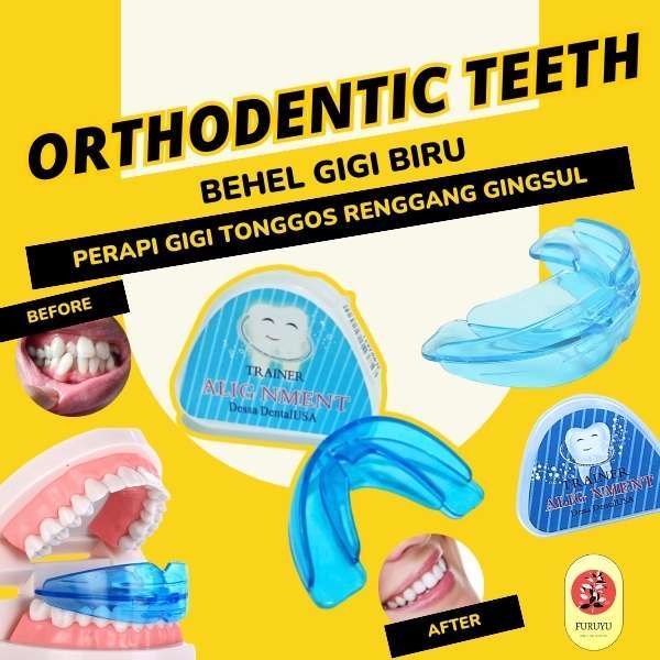 Jual Perapih Perapi Perapat Perata Behel Gigi Orthodontic Rentainer ...