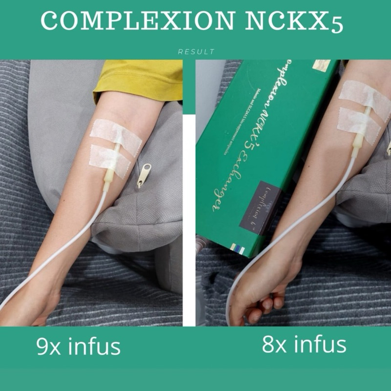 Jual COMPLEXION NCKX’5 EXCHANGER | Shopee Indonesia