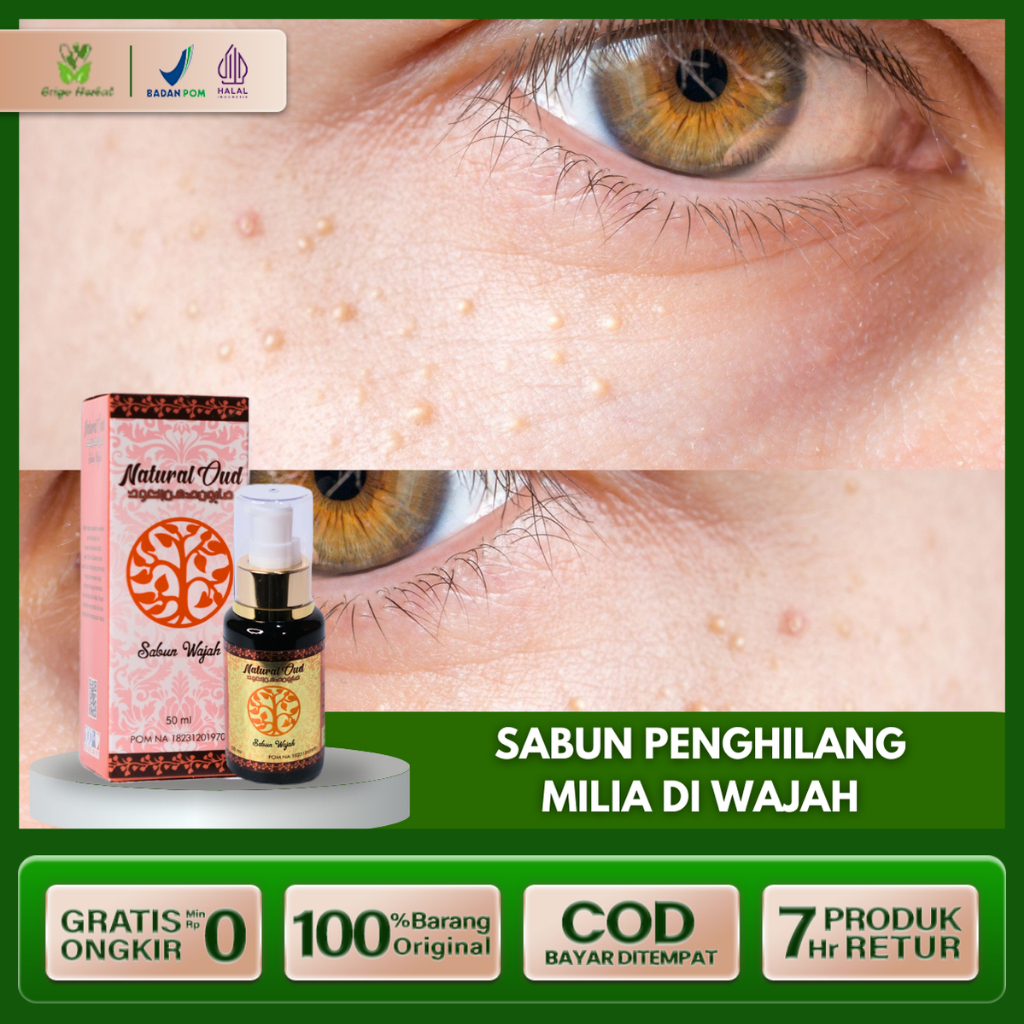 Jual Sabun Herbal Perawatan Wajah,Penghilang Milia - Penghilang ...