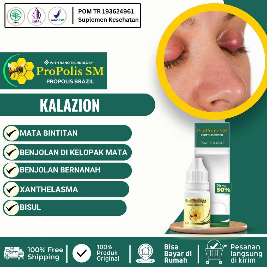 Jual Obat Penghilang Benjolan Di Mata, Kalazion, Obat Bintitan ...