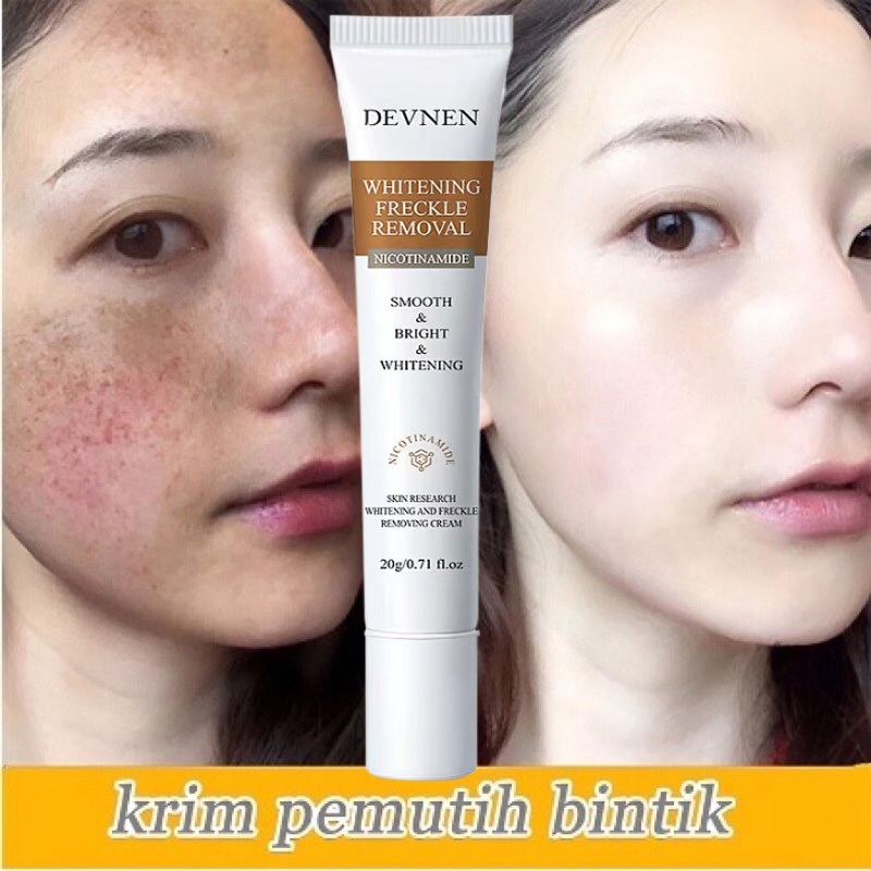 Jual Krim Penghilang Flek Hitam Krim pemutih wajah glowing cepat Krim Pemutih Melasma Cream Dark ...