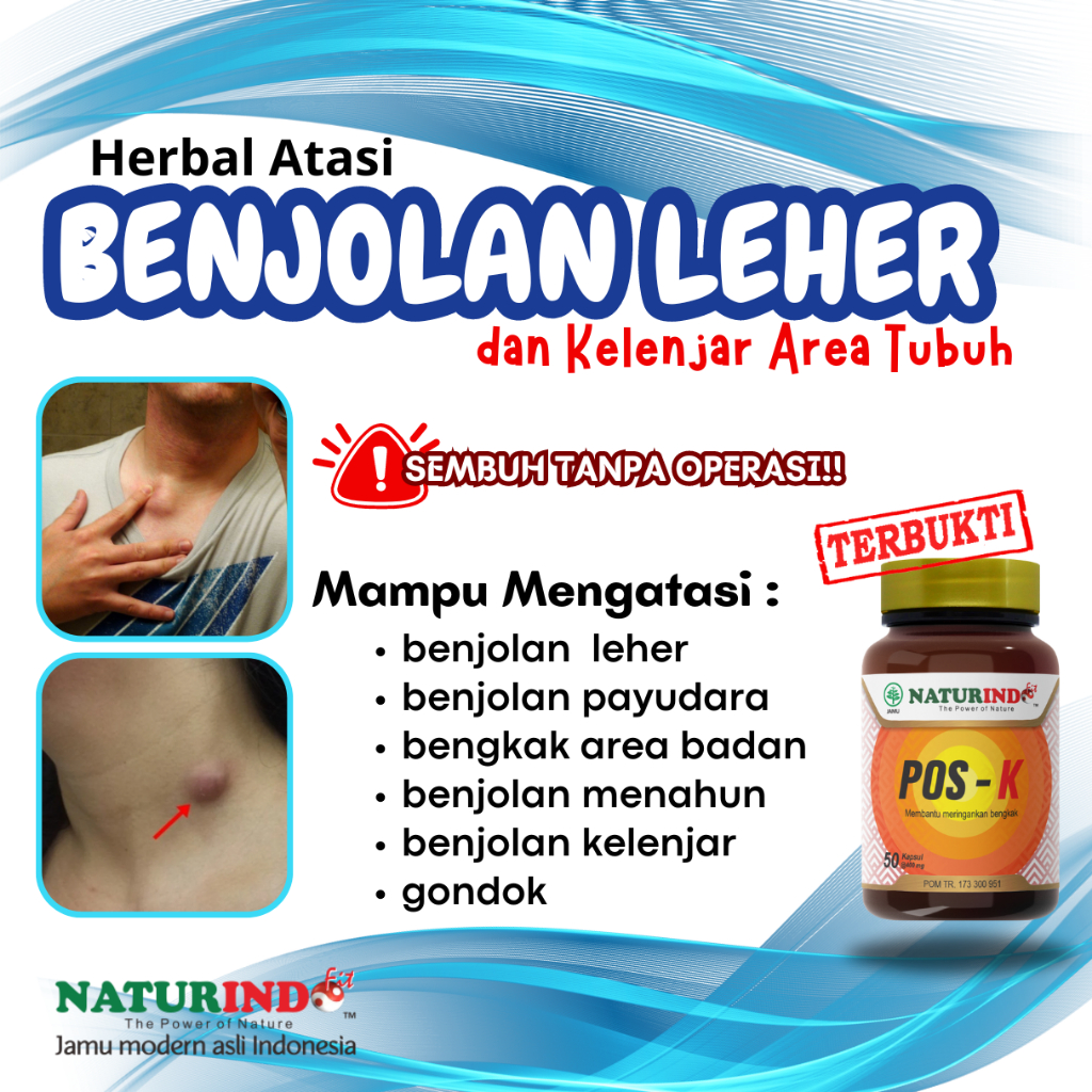 Jual Obat Benjolan Leher Kelenjar Area Tubuh Gondok Herbal Gondongan ...