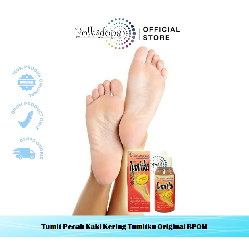 Jual Obat Cairan Herbal Tumit Pecah Kaki Badak Kering Tumitku Original ...