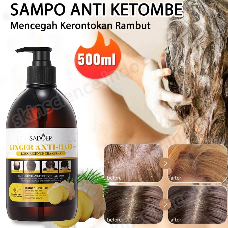 Jual Shampo Jahe 500ml Sampo Anti Ketombe Penebal Rambut Shampo Anti Rambut Rontok | Shopee ...