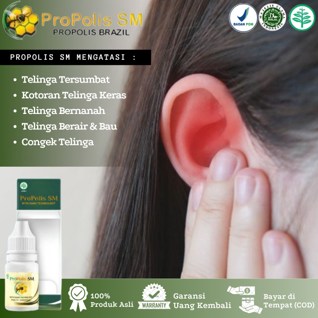 Jual Propolis SM - Solusi Atasi Telinga Tersumbat, Kotoran Telinga ...