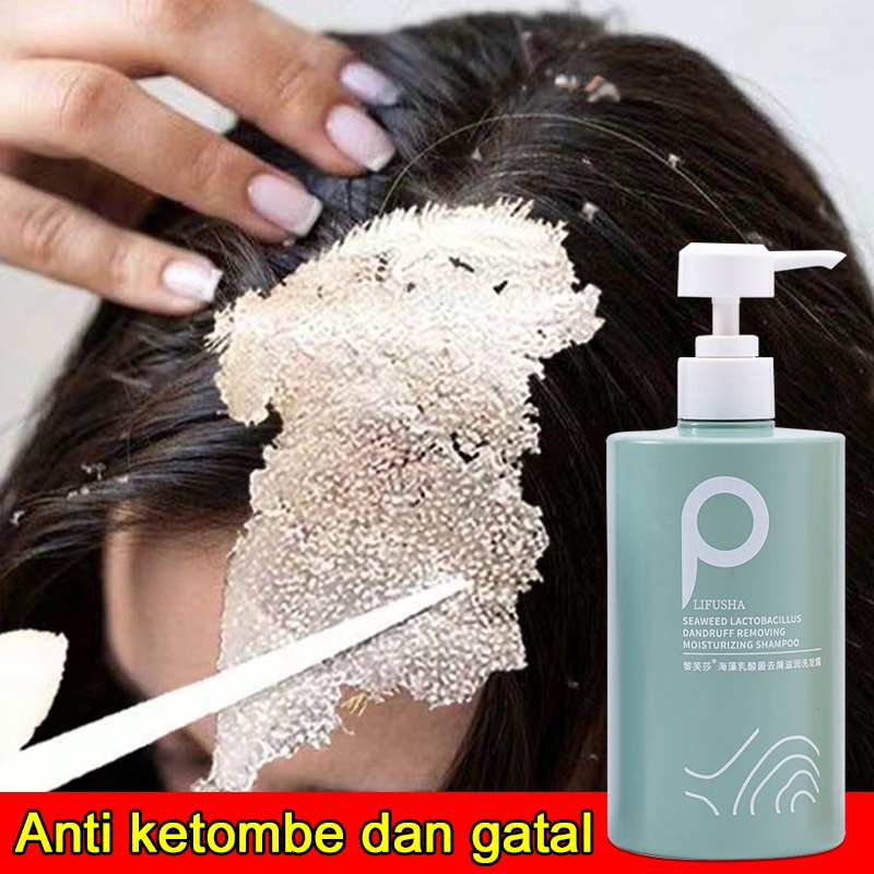 Jual Shampo anti ketombe Oil Control anti tungau shampoo anti ketombe dan gatal Gatal Kulit ...
