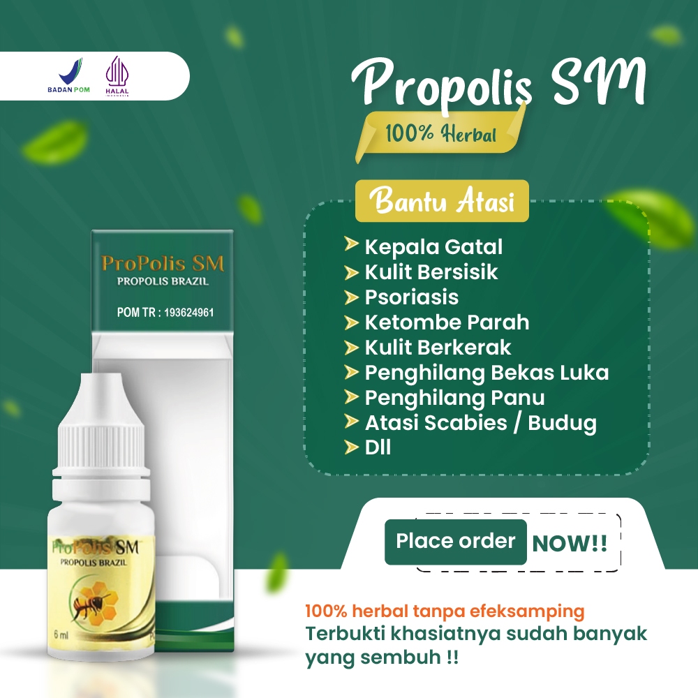 Jual Obat Koreng Di Kepala Borok di Kulit Kepala Psoriasis Kulit Bersisik Kering Luka Borok ...