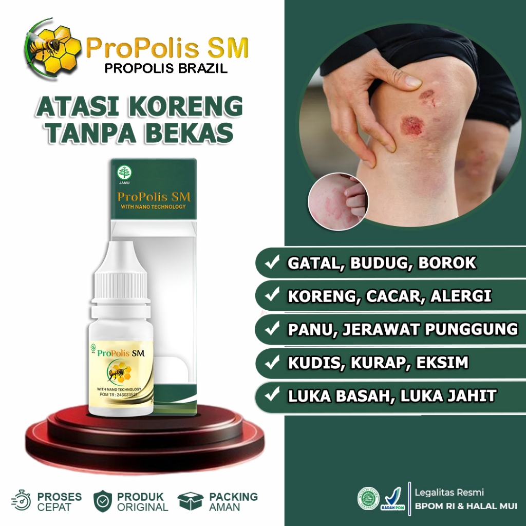 Jual Obat Koreng Penghilang Bekas Koreng Gatal Budug Cacar Bekas Luka ...