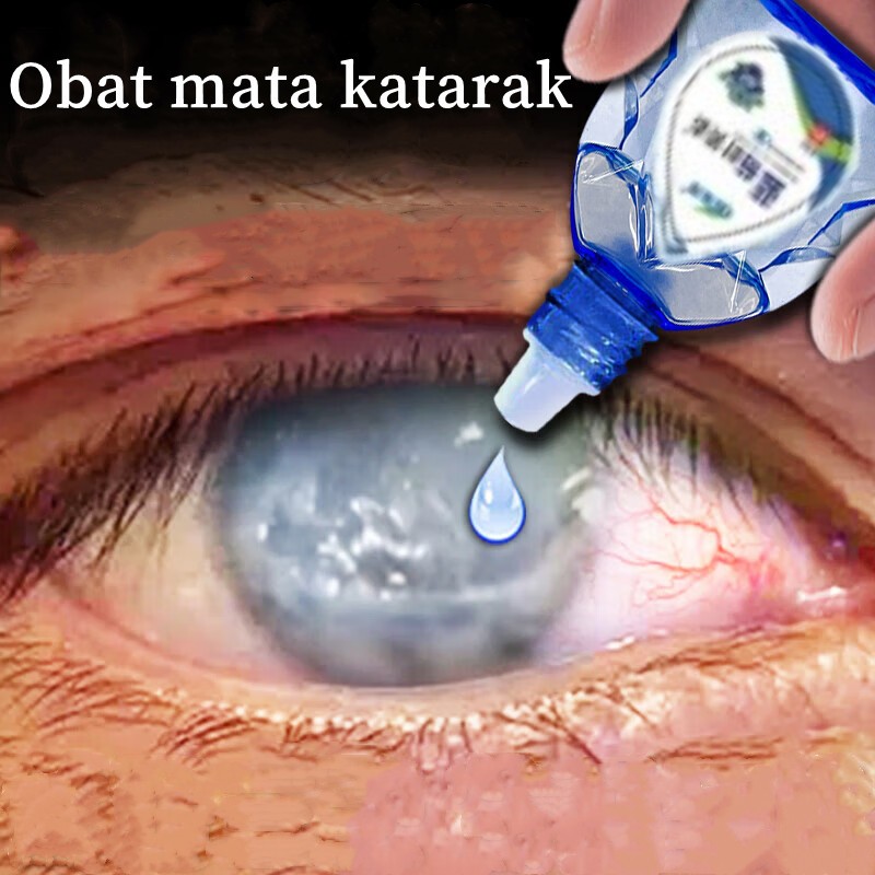 Jual Obat mata katarak Tetes mata Penghilang Lemak Di Mata kering Sakit ...