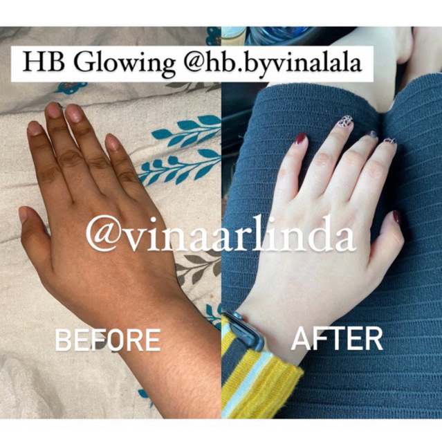 Jual HB GLOWING/HB SILVER/HB DOSTING SILVER/PEMUTIH AMPUH/PUTIH DALAM ...