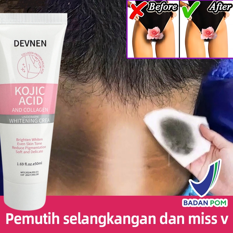 Jual Krim Pemutih ketiak 50g KojicAcid Collagen Underarm Whitening Cream Miss V Pemutih ...