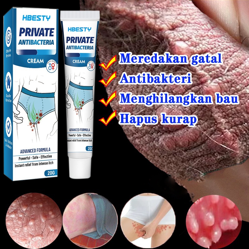 Jual gatal gatal krim kurap Anti-itching cream Psoriasis eksim Gatal ...