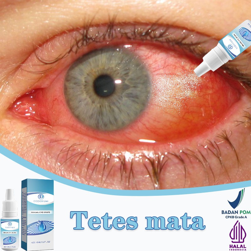 Jual Obat tetes mata Obat mata katarak Obat mata minus Obat tetes mata ...