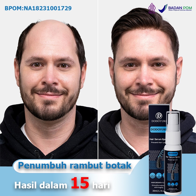 Jual Serum penumbuh rambut Penumbuh rambut botak Hair tonic rambut ...