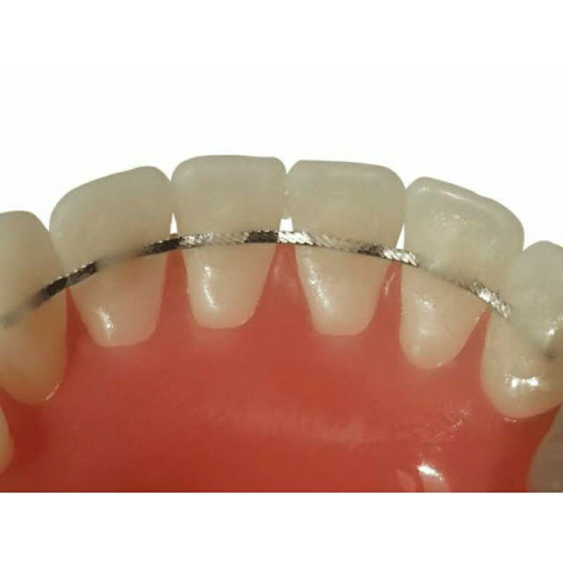 Jual BRACKET LINGUAL RETAINER ORTHO 1.2 MM ISI 2 PC / BEHEL GIGI ...