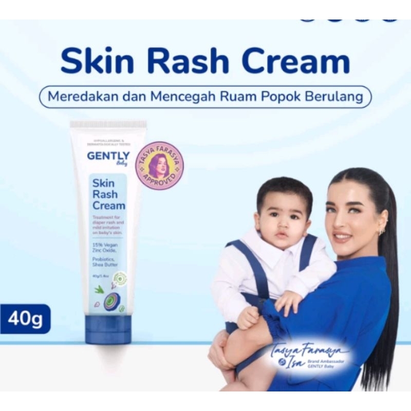 Jual Gently Baby Skin Rash Cream | Shopee Indonesia