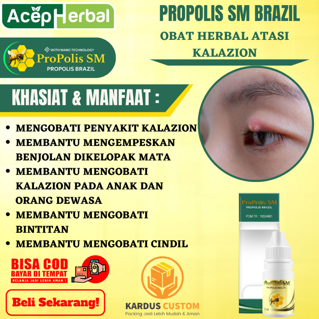 Jual Obat Kalazion - MENGEMPESKAN BENJOLAN DI KELOPAK MATA - Obat ...
