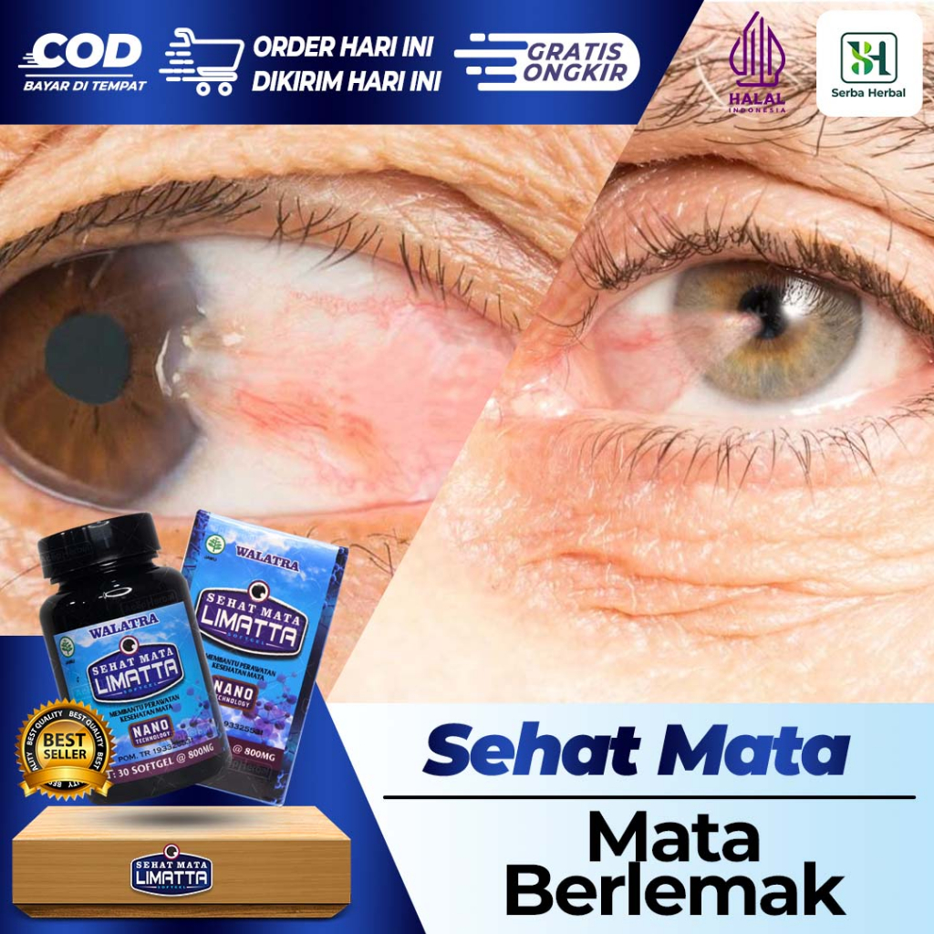 Jual LIMATTA SEHAT MATA - Obat Herbal Bintik Dimata Mata Berlemak pterygium Mata Berkabut Lemak ...