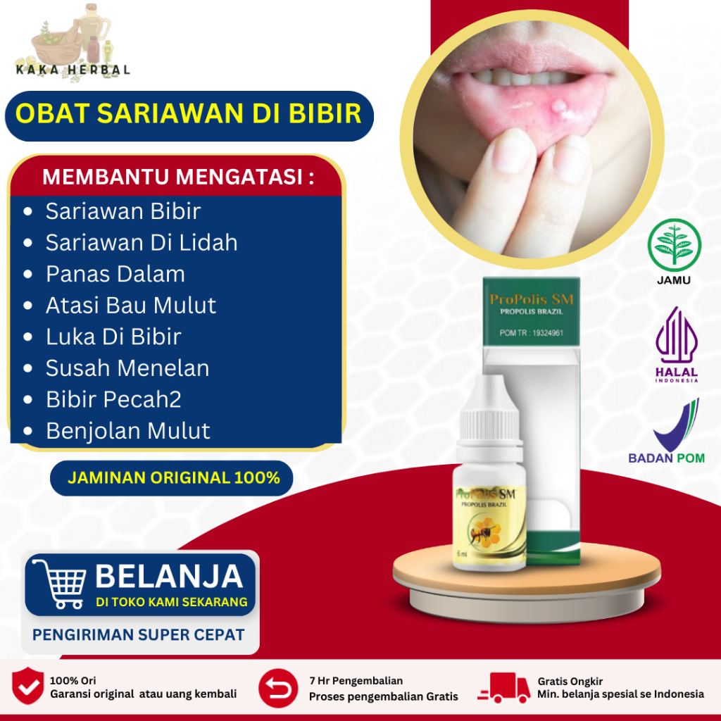 Jual Kaka Herbal - Obat Sariawan Di Bibir Mulut Dan Lidah Panas Dalam ...