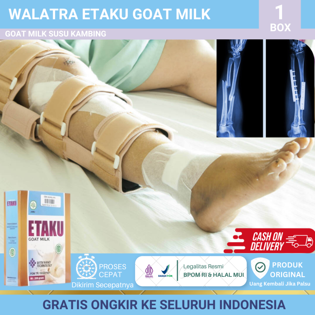 Jual Susu Kalsium Patah Tulang, Penyembuh Patah Tulang, Tulang Retak ...