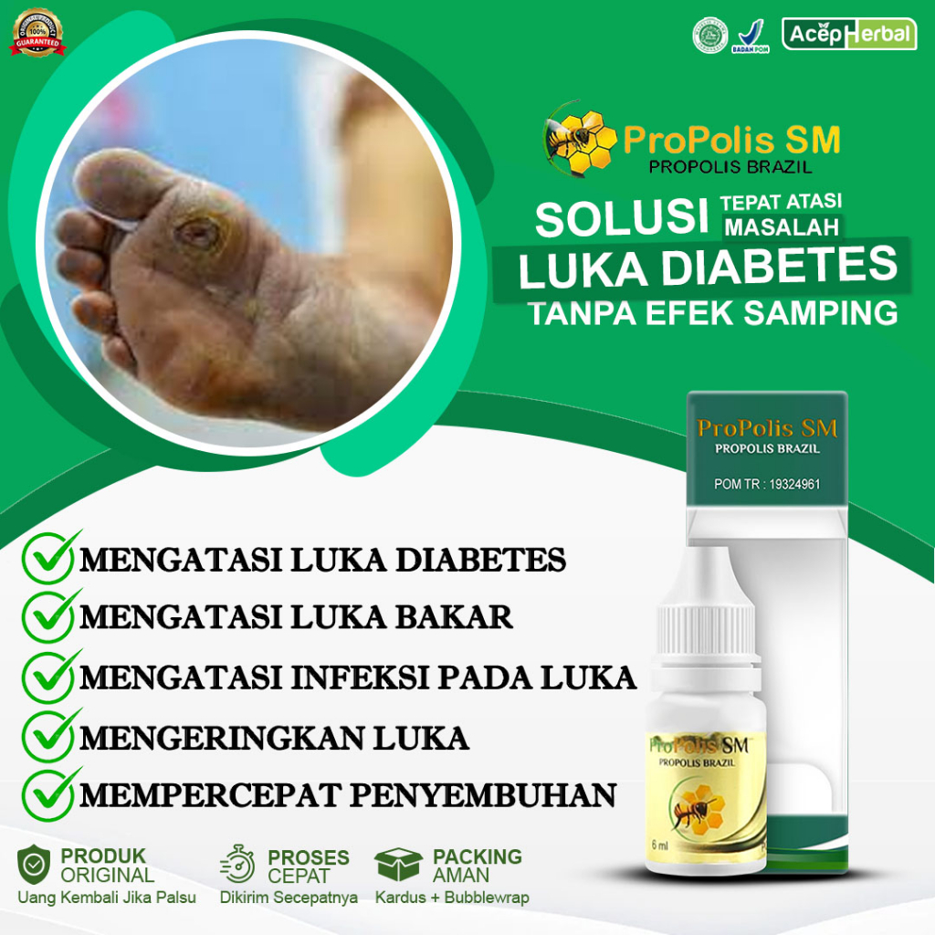 Jual Obat Luka Diabetes Pengering Luka Diabetes Luka Basah Luka Kering ...