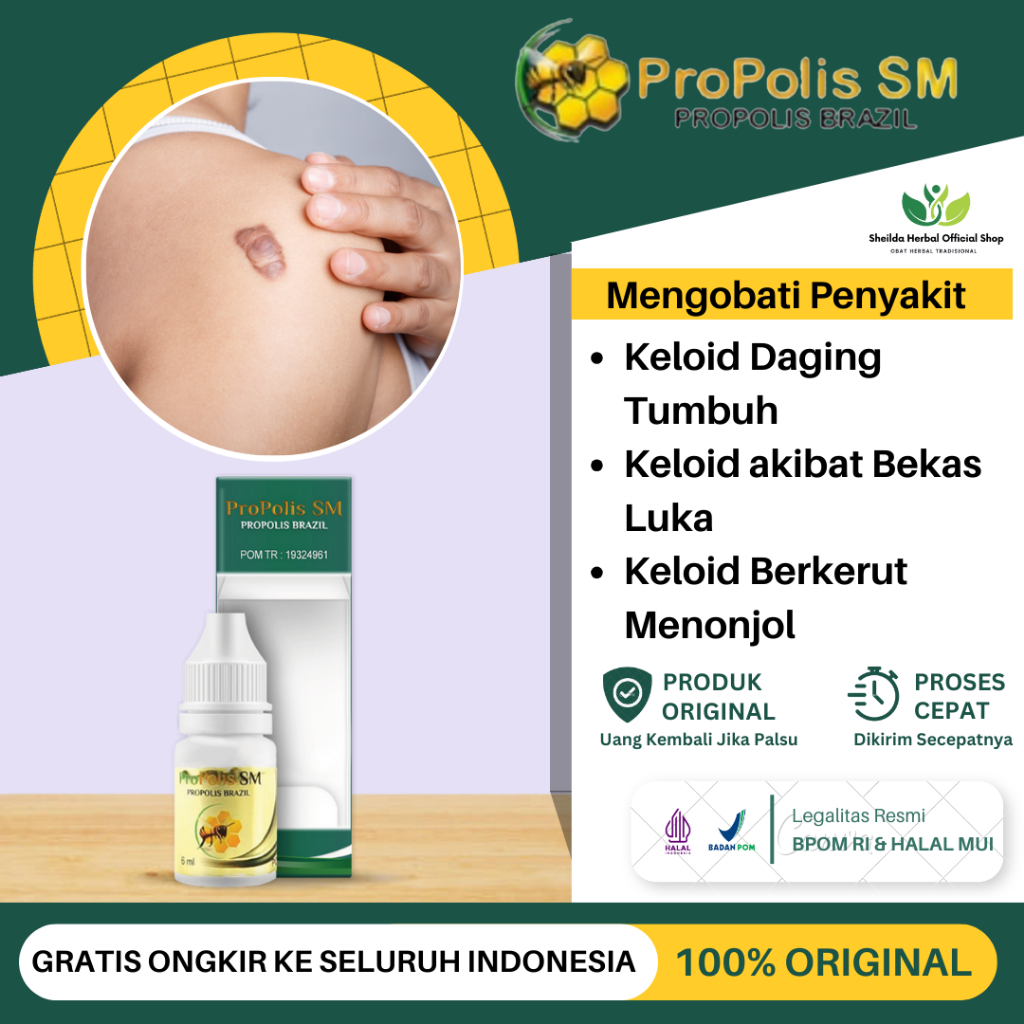 Jual Obat Keloid, Penghilang Daging Jadi, Bekas Luka Menonjol, Infeksi ...