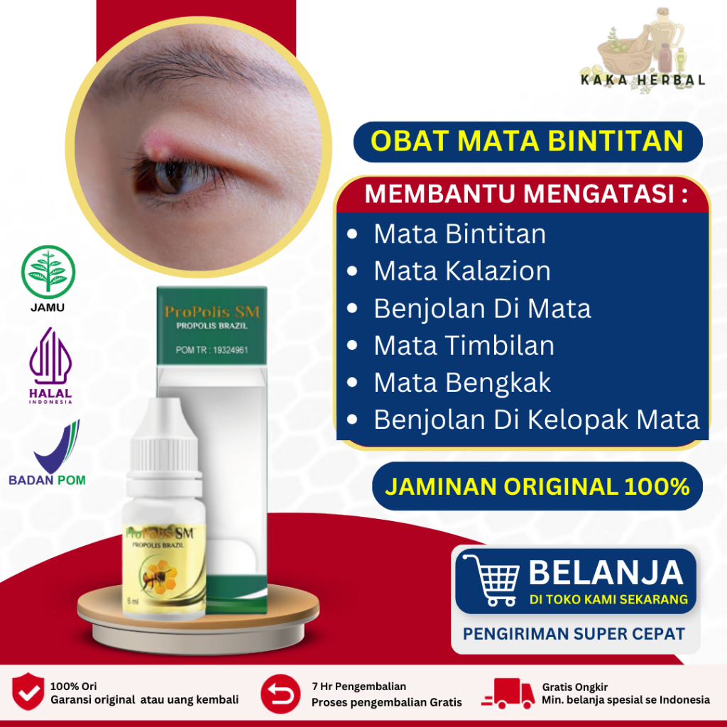 Jual Obat Mata Bintitan, Obat Mata Kalazion, Obat Benjolan Di Kelopak ...