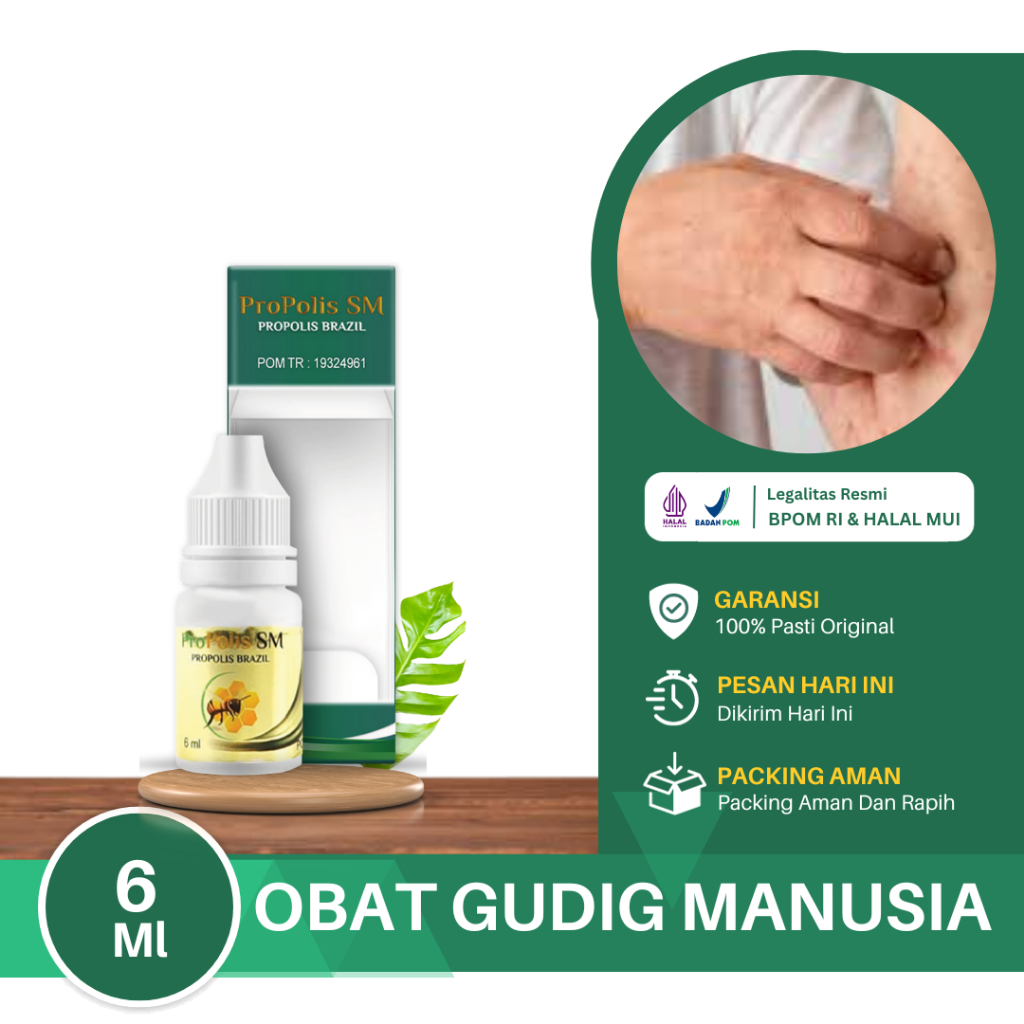 Jual Obat Gudig Manusia, scabies manusia / kudis, Gudik / Gudikan ...