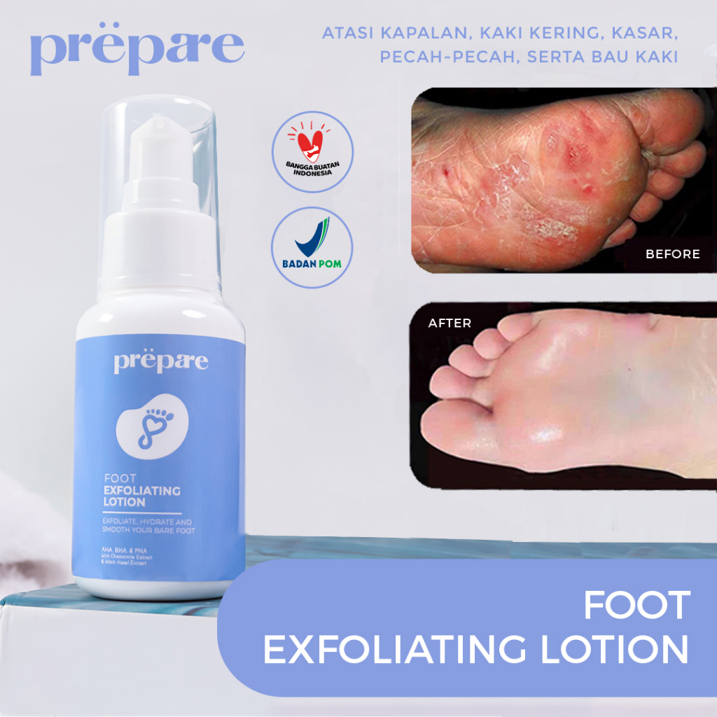 Jual PREPARE Lotion Pembersih Kaki Kapalan Obat Jamur Kaki Pecah Kering ...