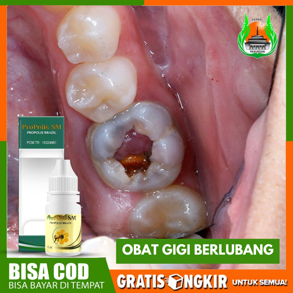 Jual Obat Sakit Gigi Berlubang, Gusi Jadi bengkak , Obat Gigi Berlubang , Gigi NyutNyutan ...