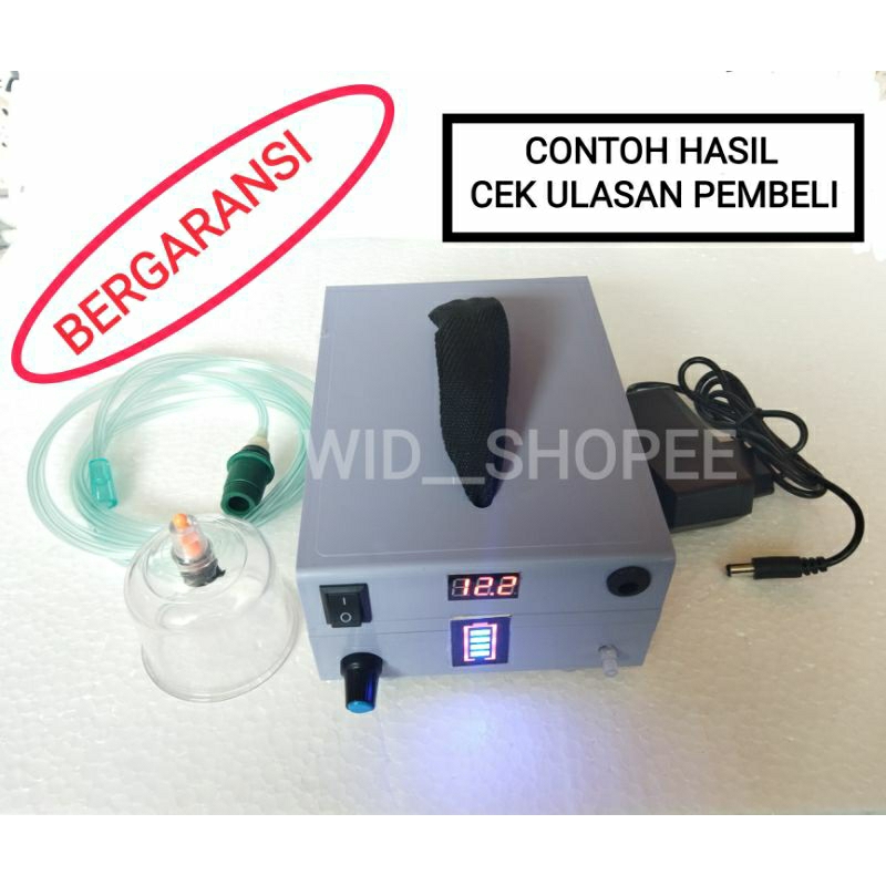 Jual Vakum Bekam Elektrik DIY/BEKAM KEPALA tanpa cukur! | Shopee Indonesia