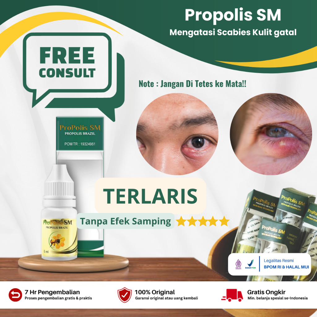 Jual Obat Mata Bintitan Kalazion Benjolan Di Kelopak mata Herbal ...