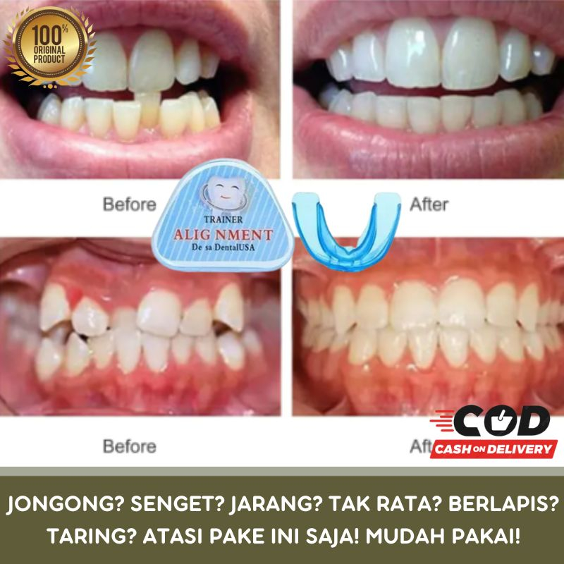 Jual Alat perapih perapi perata gigi ori original doctor behel gigi ...